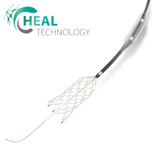 CREDO® heal Stent - Acandis