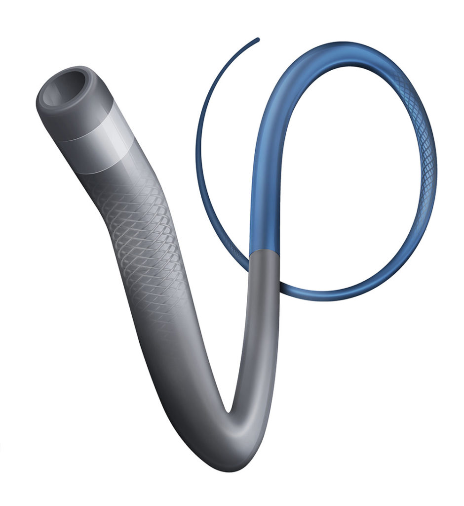 NeuroBridge® Catheter - Acandis