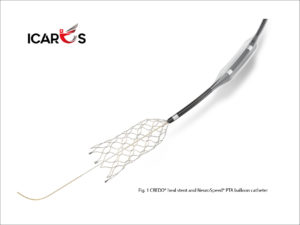 Acandis - Engineering stroke solutions